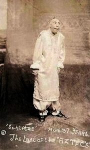 Human Oddities (The Most Severe Cases In History) - OdditiesBizarre.com
