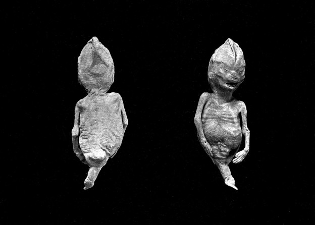 10 Deformed People (Shocking Images & Footage) - OdditiesBizarre.com