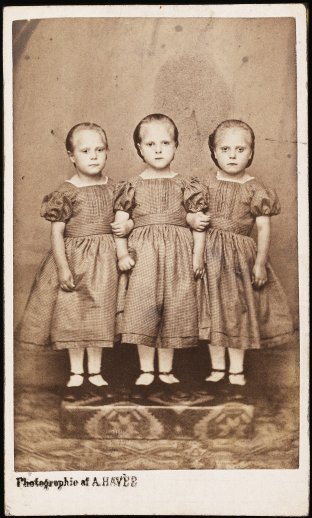 Conjoined Triplets - OdditiesBizarre.com