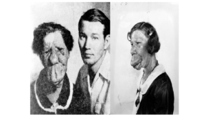 Grace McDaniels: The Original "World's Ugliest Woman" - OdditiesBizarre.com